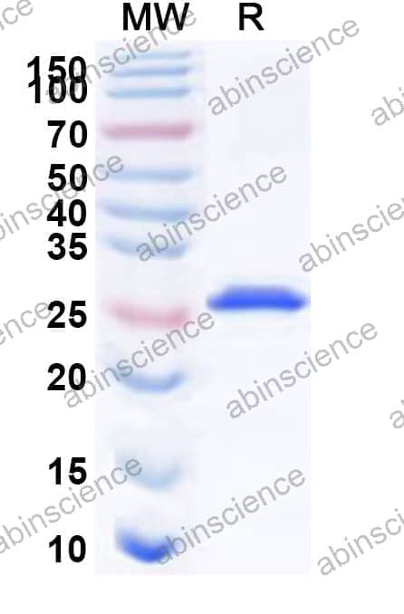 Buy Recombinant Human NAB1 Protein | For ELISA and WB