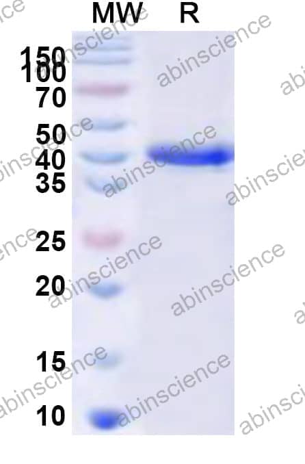 Buy Recombinant Human LIPN Protein, N-His | For ELISA, Immunogen, SDS ...