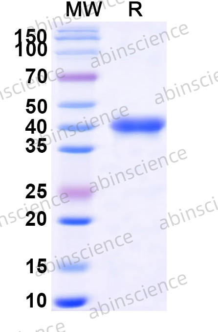 Recombinant Mouse PRKG2 Protein, N-His_abinScience